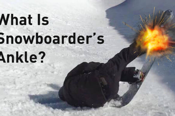 What Are Lib Tech TNT Bases Actually Made Of? - Onyx Snowboard School